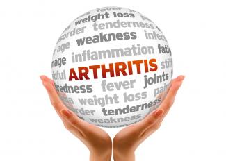 Management of Arthritis | Arthritis Management | How to manage ...